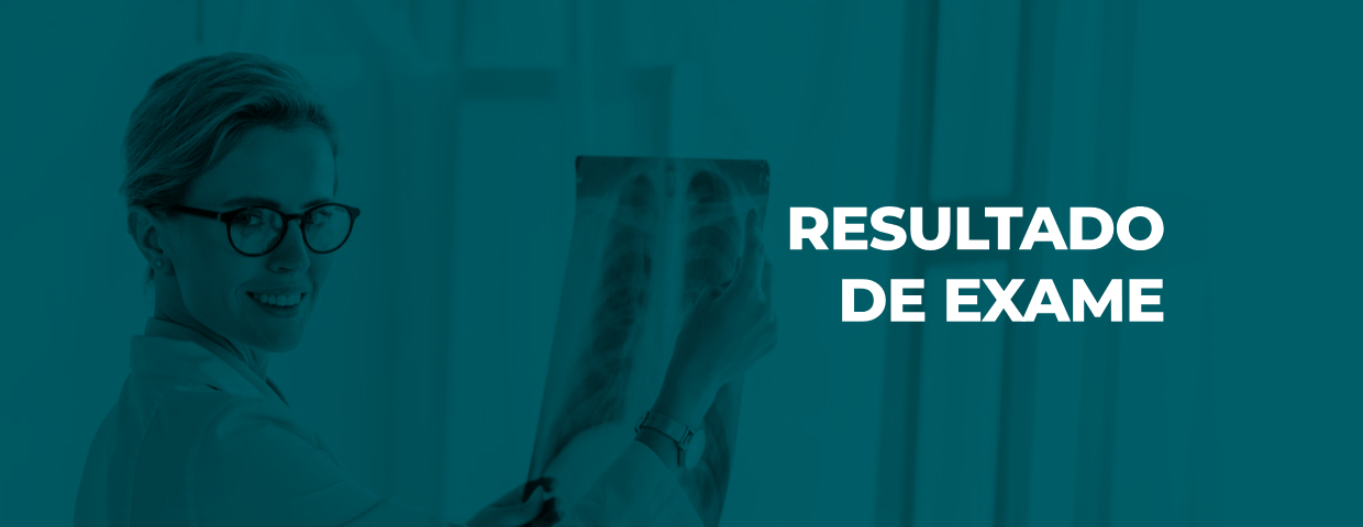 Resultado De Exame Medcor Ms Cardiologista Campo Grande Ms